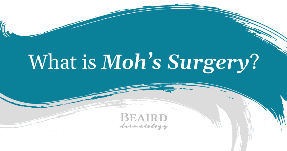 What Is Mohs Surgery - Beaird Dermatology, SC